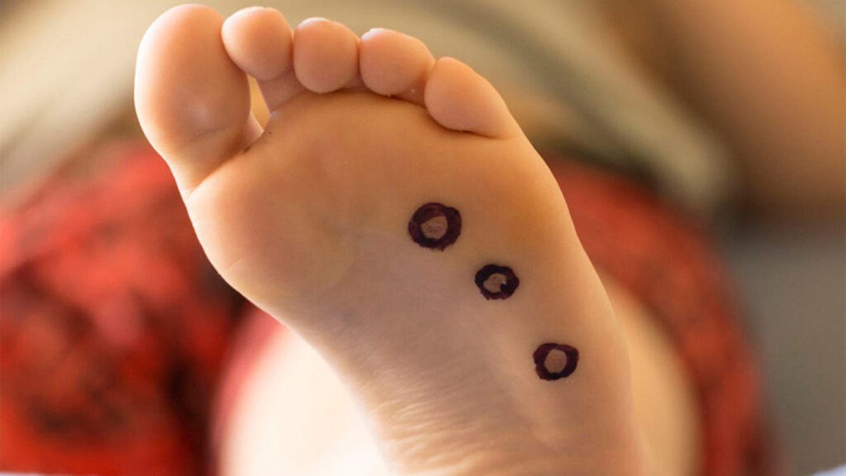 Wratten! Hoe besmettelijk zijn ze eigenlijk? - Oudersenzo